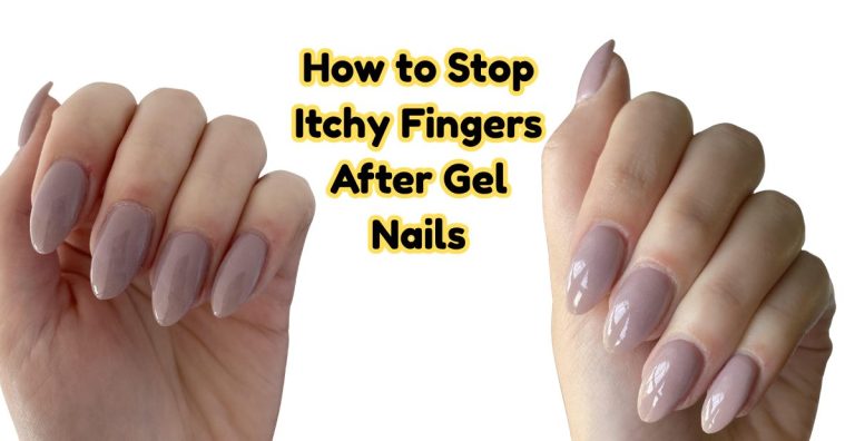 How to Stop Itchy Fingers After Gel Nails
